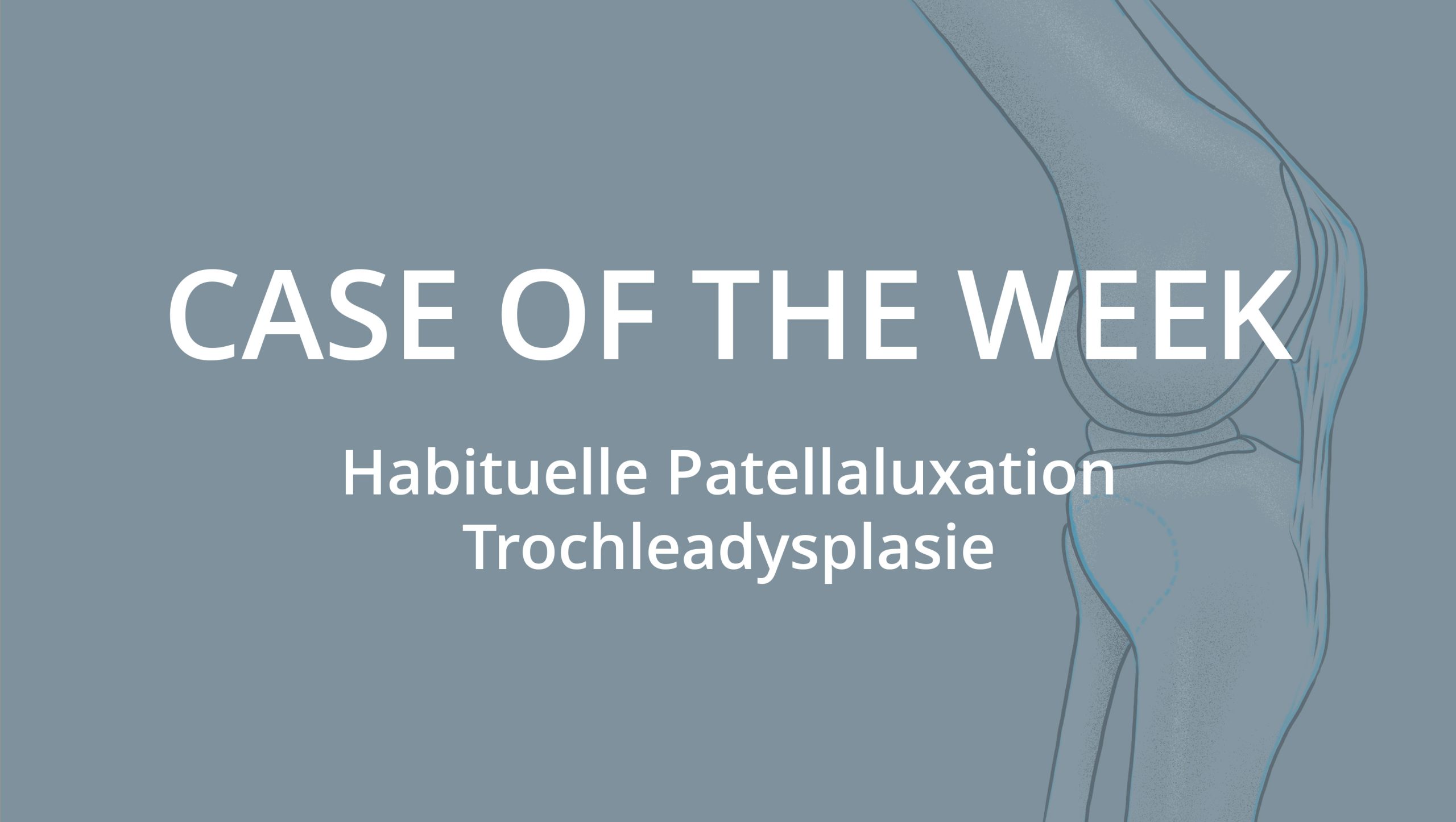 Habituelle Patellaluxation - Trochleadysplasie | Orthopäde Wien