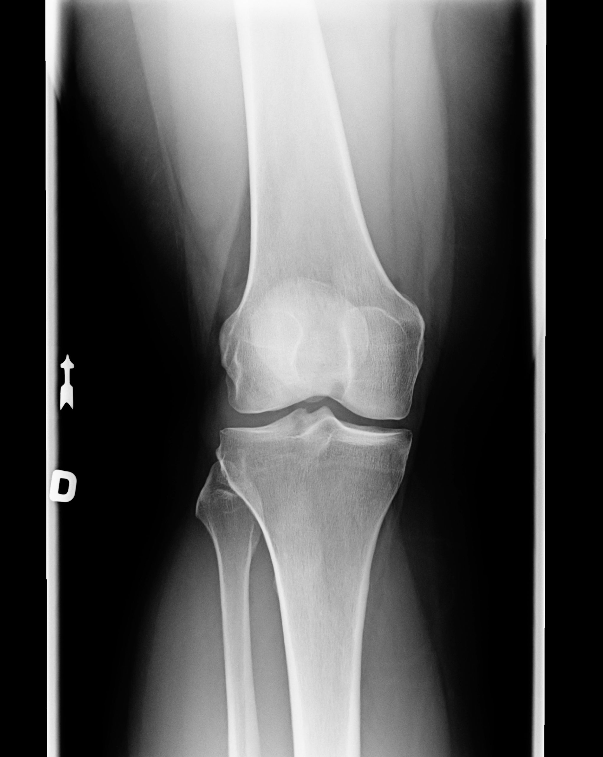 Patella - Orthopäde 1080 Wien | Dr. Martin Gruber