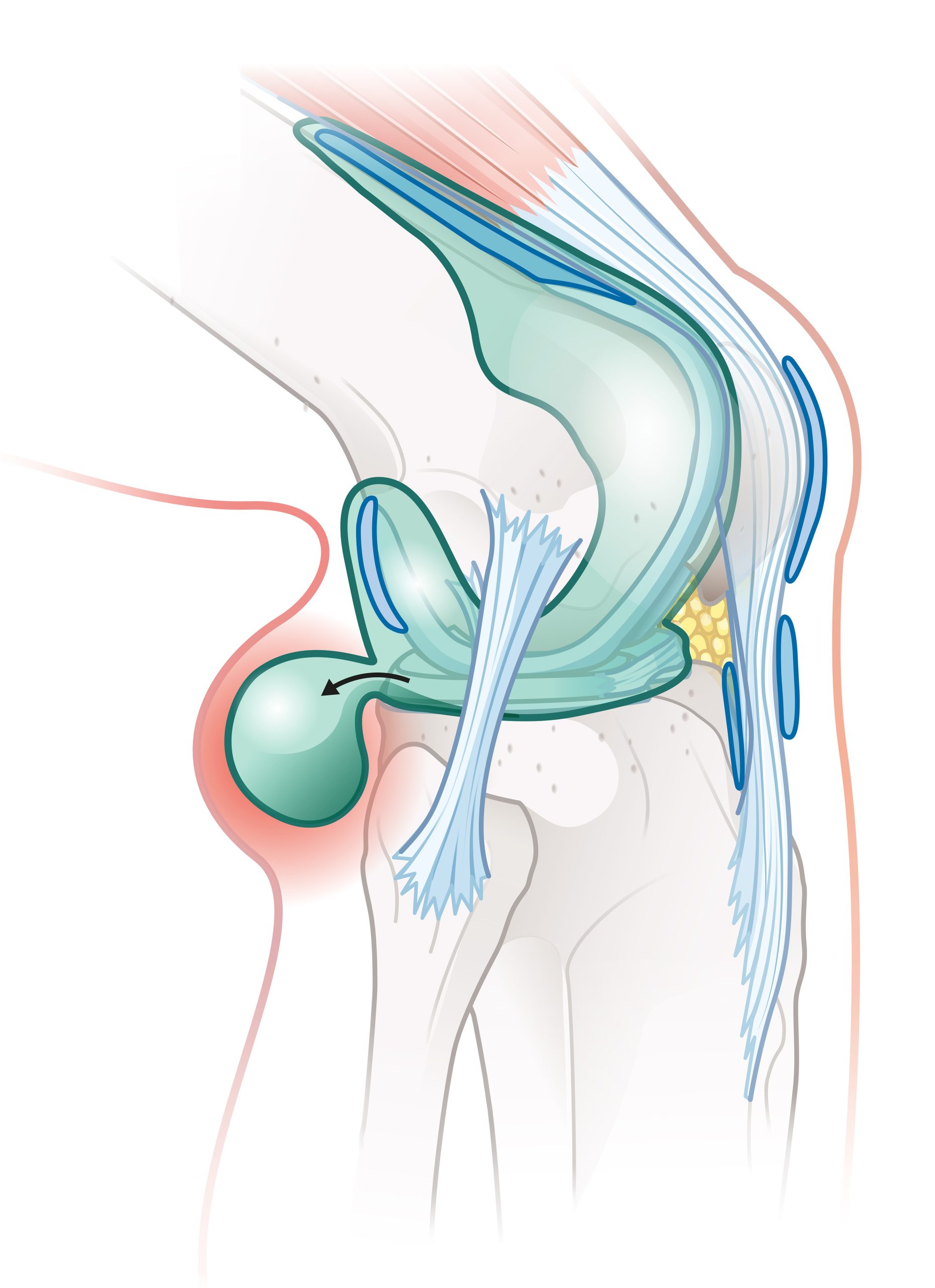 Bakerzyste | Behandlung beim Orthopäden aus Wien | Dr. Gruber