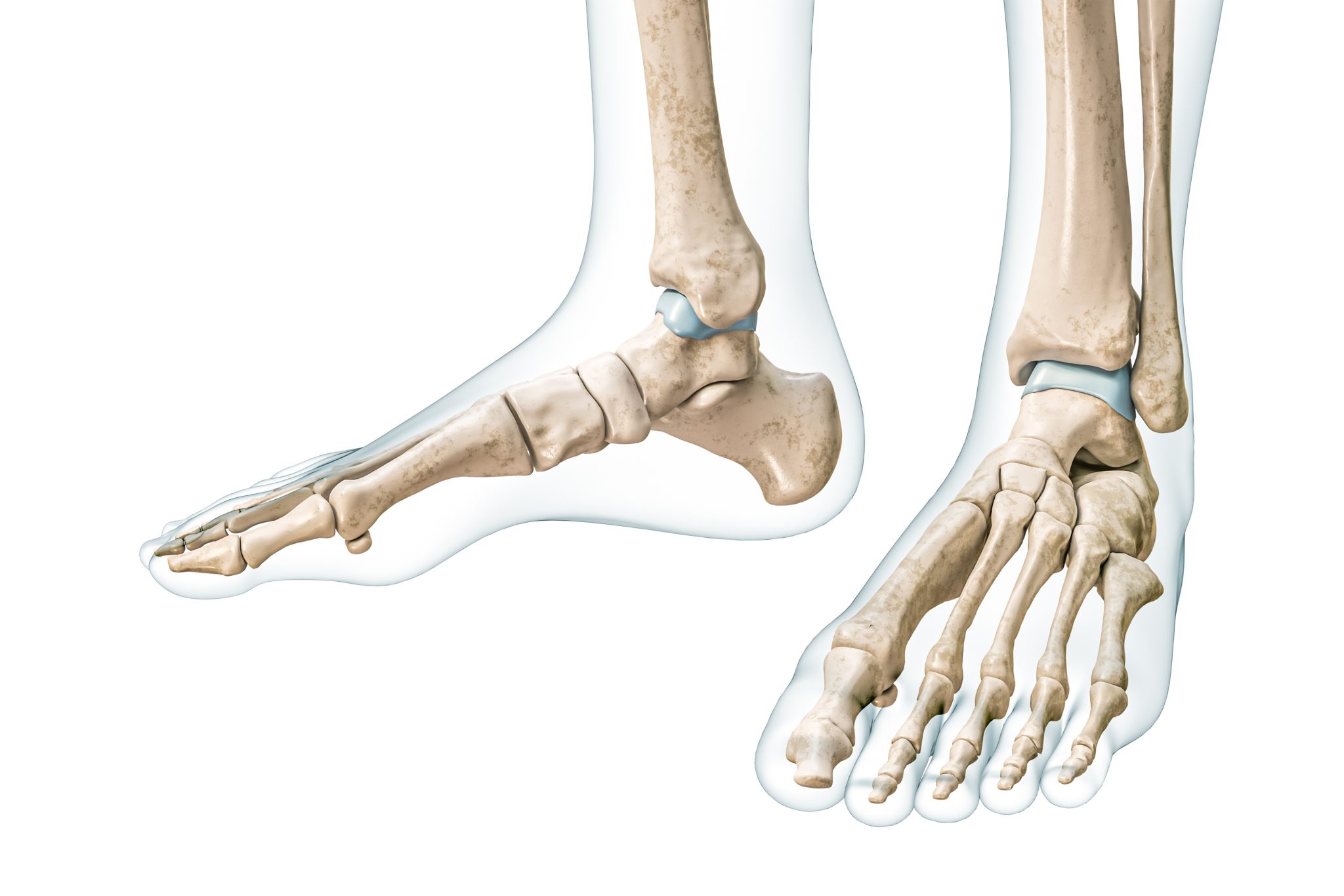 Bone marrow edema: causes, symptoms & treatment